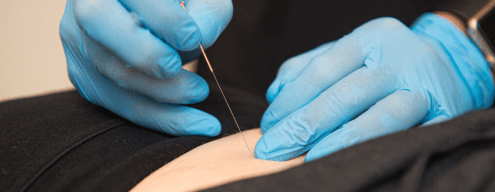 Intramuscular Stimulations | Joint, Heel & Hip Pain Managment | Pain ...